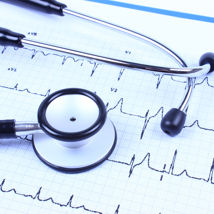 Electrocardiograma (EKG) en reposo – DEGA Laboratorios