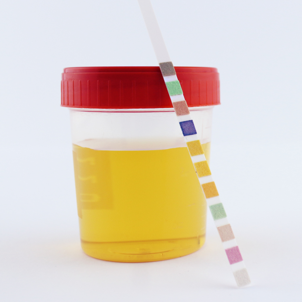 Examen de Orina – DEGA Laboratorios